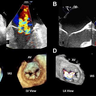 Case 1 Transthoracic Echocardiography Download Scientific Diagram