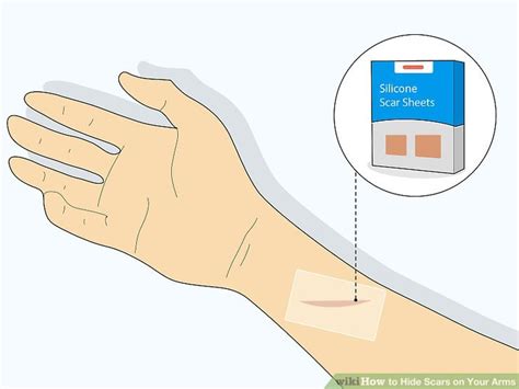 Simple Ways To Hide Scars On Your Arms WikiHow