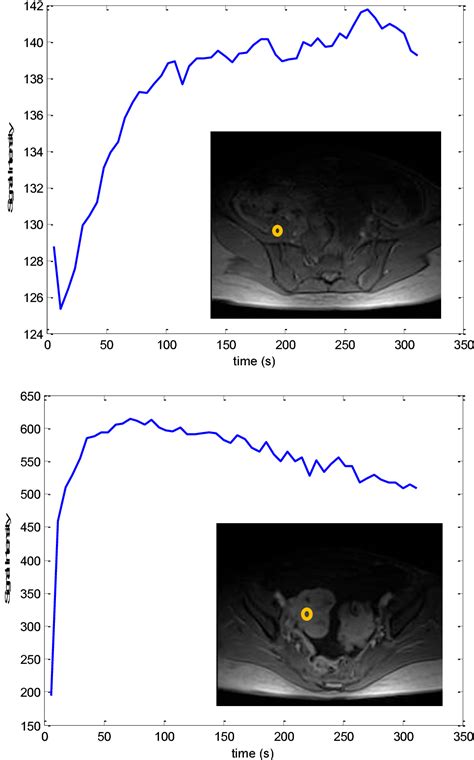 Figure 1 From An Automated Non Rigid Registration Method For Accurate Quantification Of Dynamic