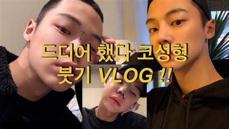 코성형 붓기 Vlog 너무 안부어서 영상 망했다 Youtube