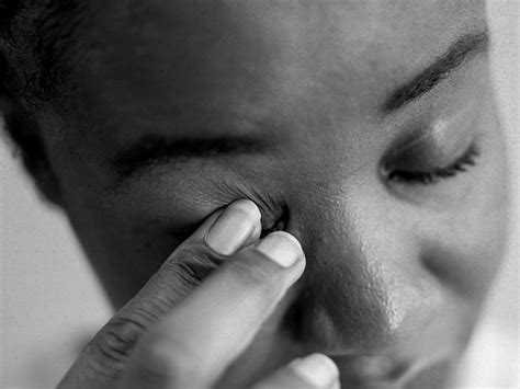 Stye Symptoms Treatment And Prevention Stye Nhs