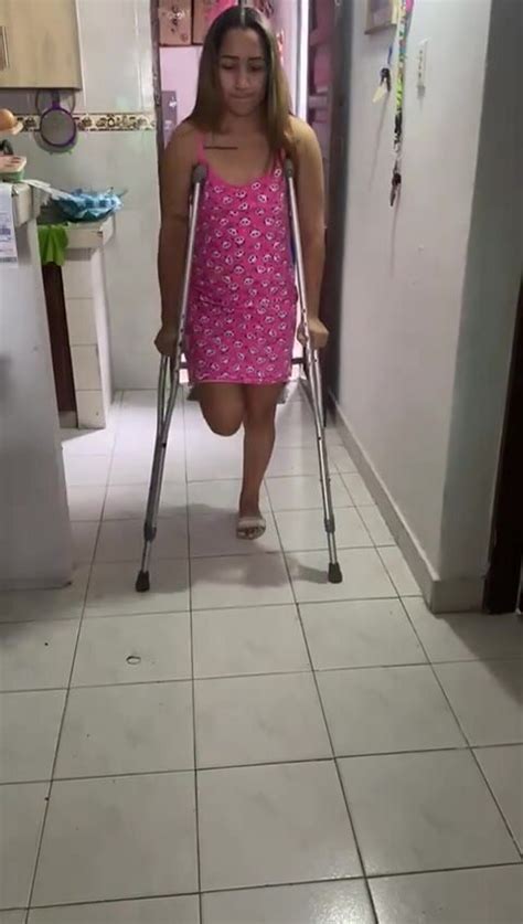 Girl In Amputee Foot 日本語で