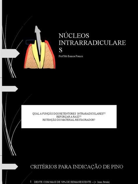 Retentor Intra Radicular Pdf Dente Materiais