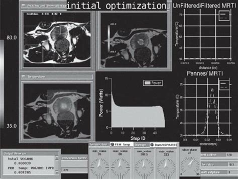 Various Visualizations Of The Data From The In Vivo Tests Of The