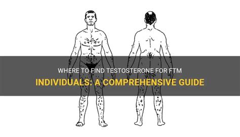 Where To Find Testosterone For Ftm Individuals A Comprehensive Guide