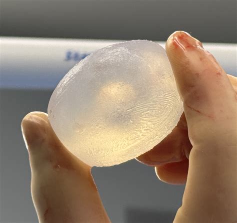 Hollow Chamber Testicle Implants Malakon Rex Improved Design