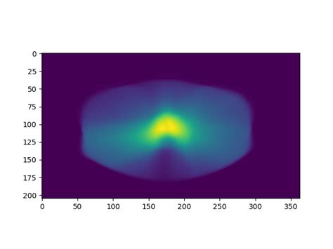 Convert RT Structures Into Binary Images Dr Ilias Sachpazidis