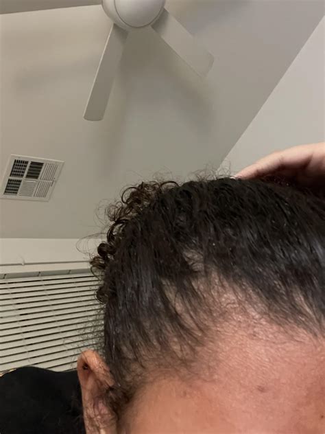 Is My Hair Thinning Scrolller