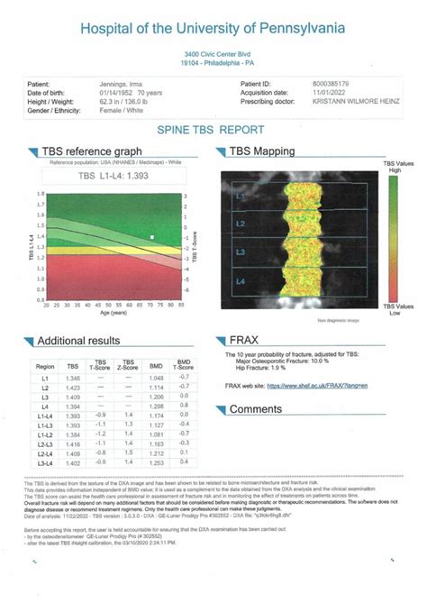 Irma Jennings Bone Health Test Results Dxa 2020