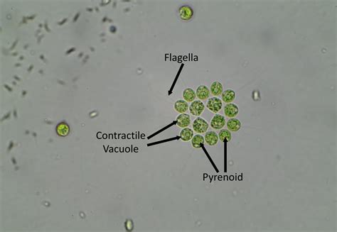 Green Algae Under Microscope 400x
