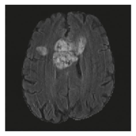 Case 3 The Image Is Characterized By Complex Edges And Many Contour Download Scientific