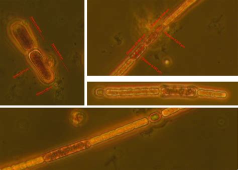 Cyanobacteria Identification Help﻿ A Slice Of Plankton