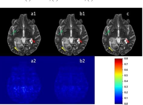 Figure 1 From A 3d Multi Modal Network For Mri Fast Reconstruction
