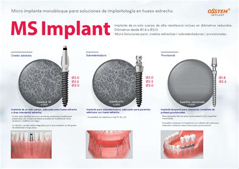 Catálogos Marketing Osstem Spain
