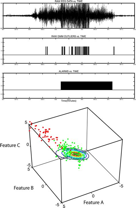 An Adaptive Unsupervised Machine Learning Approach For Seizure