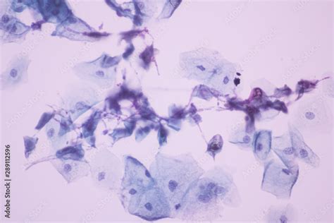 Candida Fungus Slide