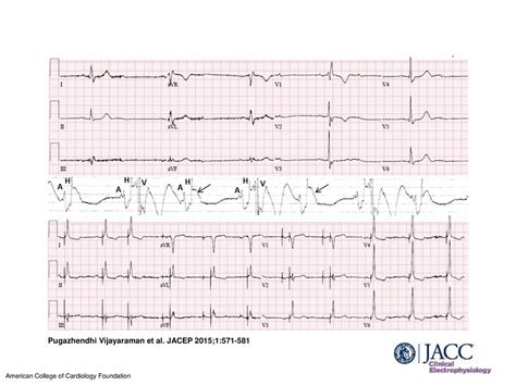 Pugazhendhi Vijayaraman Et Al Jacep 2015 1 Ppt Download