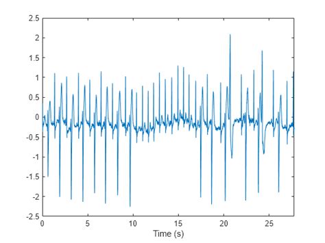 Vmd Variational Mode Decomposition Matlab