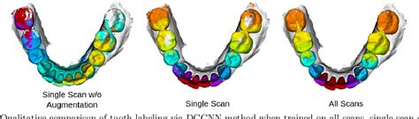 automatic tooth segmentation from 3d dental model using deep learning