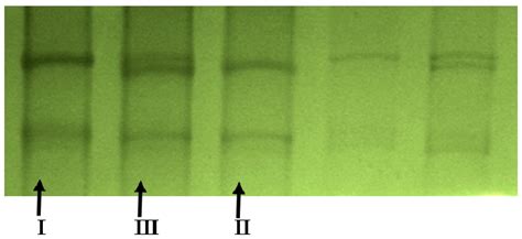 Sscp Pattern Of Exon 13 Of Kcnq1 Download Scientific Diagram