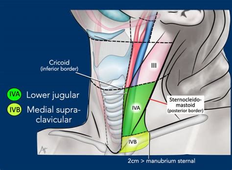 Neck Lymph Node Locations Nursessity The Radiology Assistant