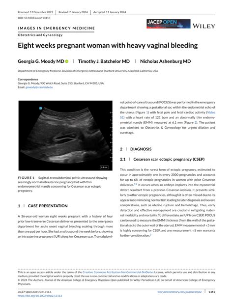 Pdf Eight Weeks Pregnant Woman With Heavy Vaginal Bleeding