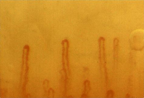 Capillaroscopic Image In A Healthy Human Classical Loop Download