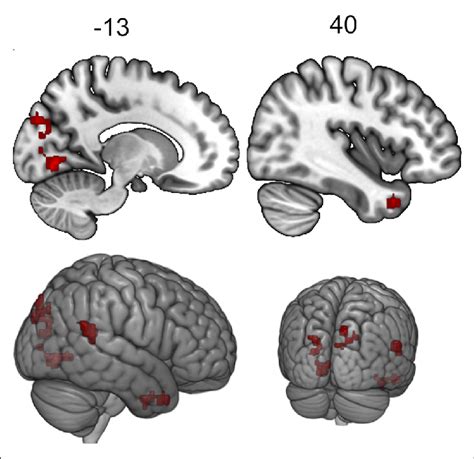 Clusters Showing Increased Connectivity With The Left Posterior Download Scientific Diagram
