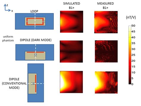 Sar Reduction In 7t C Spine Imaging Using A Dark Modes Transmit Array Strategy Abstract