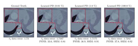 A Reconstructions Using The Learned Primal Dual Method Trained With Download Scientific