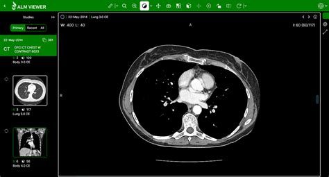 The Role Of Alm Dicom Viewer In Advancing Ultrasound And Pathology Imaging A Comprehensive
