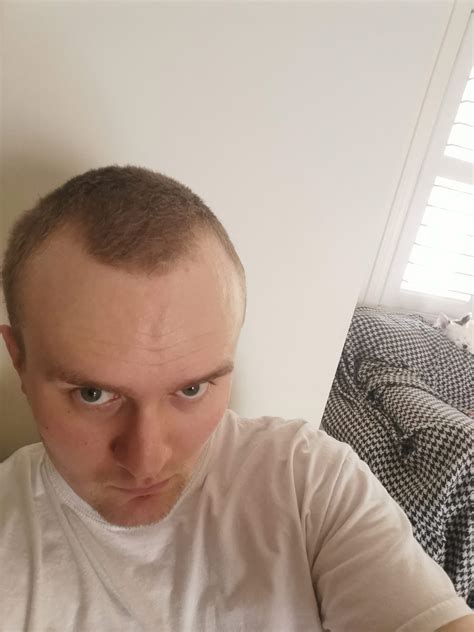 Patrick Greene Medium