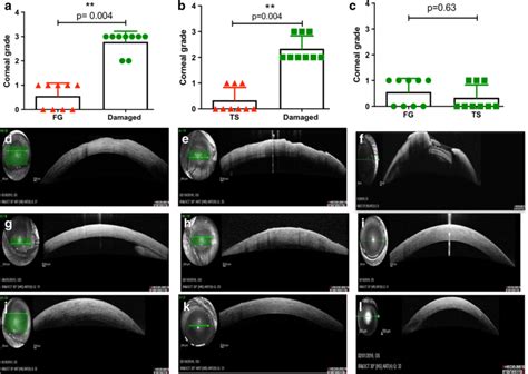 Evaluation Of Corneal Surface After Msc Transplantation Corneal Download Scientific Diagram