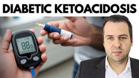 Understanding Diabetic Ketoacidosis Dka Symptoms Causes Treatment