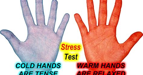 Stress, Anxiety, Biofeedback, Relaxation Skills: One Hand Warmer than ...