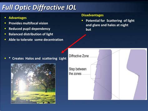 Ppt Eyediff Plus 350d Diffractive Multifocal Iol “a New Alternative