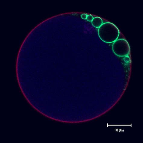 Vacuole Cel Celkenmerken