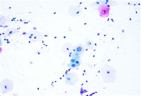 Asc Us Cells In Patient Using Ria Pap 40x Download Scientific Diagram