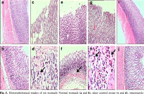 Figure 5 From Development Of Bilayer Floating Tablet Of Amoxicillin And Aloe Vera Gel Powder For