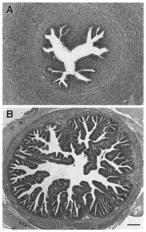 Sections From The Uterotubal Junction A And Ampulla B Of A