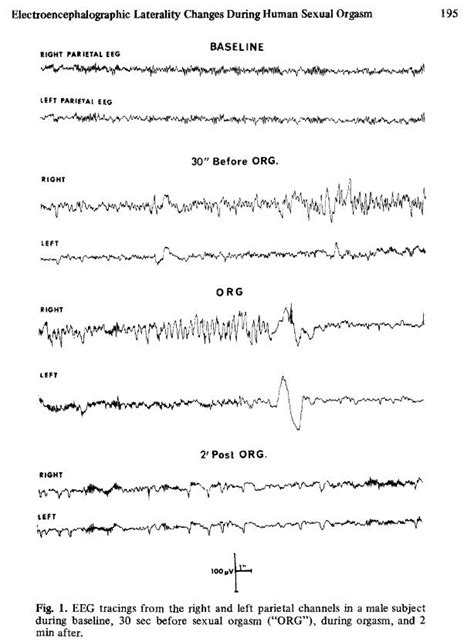 Orgasm And Eeg In 1976 A Journal Article I Read — Science Sex And