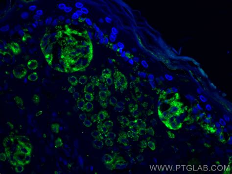 Cd63 Antibody 25682 1 Pbs Proteintech