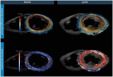 Myocardial Microstructure Probed With Diffusion Tensor Imaging In A Download Scientific Diagram