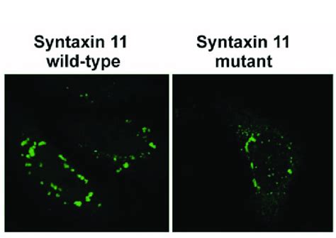 Syntaxin 11 Is Not Membrane Anchored By The Cysteine Rich Download Scientific Diagram
