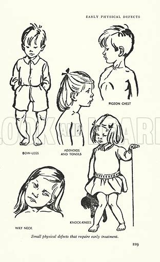 Small Physical Defects That Require Early Treatment Stock Image Look