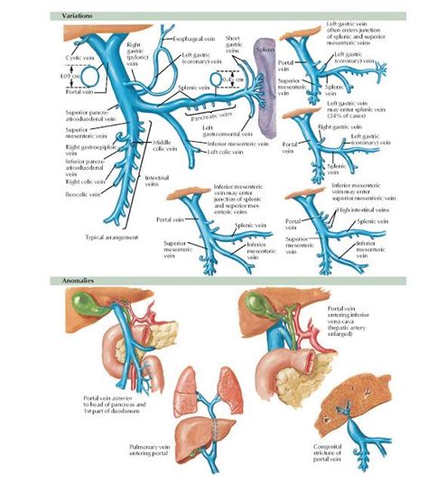 Variations And Anomalies Of Hepatic Portal Vein Anatomy Cystic Vein