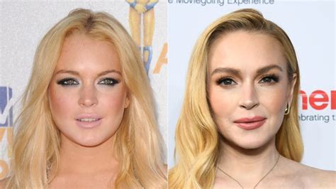 Lohan Before And After Plastic Surgery