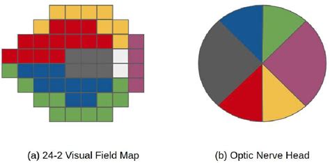 Figure 2 From A Multimodal Deep Learning Model For Predicting Future Visual Field In Glaucoma