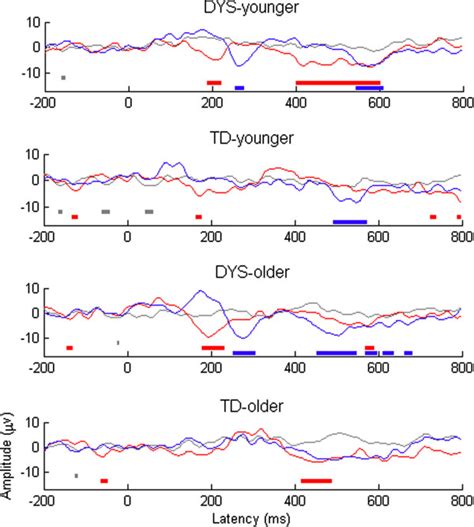 Average Mismatch Responses From First Principal Component By DYS Status Download Scientific