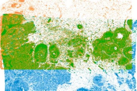 Computational Tool Offers New Possibilities For Spatial Genomics